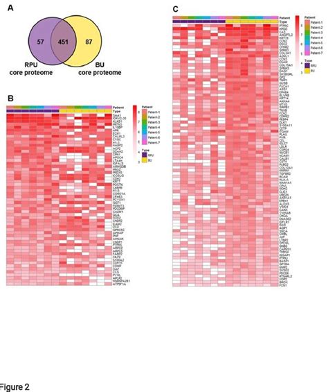 Figure 2 From Quantitative Analysis Of The Renal Pelvic And Bladder