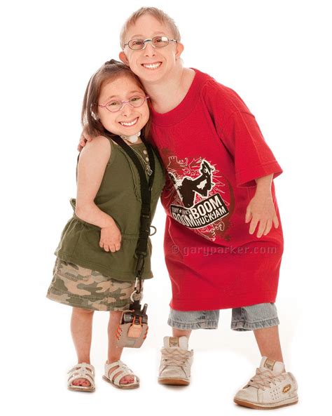 Pin On Primordial Dwarfism