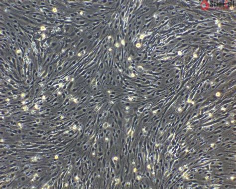 Hpsc Derived Endothelial Cells H9 Ec