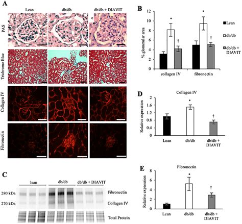 diabetic db db mice develop glomerular fibrosis which is prevented in