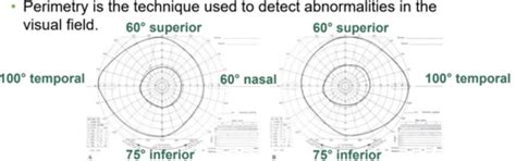 5 Visual Field Testing In Glaucoma Flashcards Quizlet