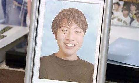 “17세 아들 사랑니 뽑으러 갔다가 죽었다” 日 아버지의 사연… 병원서 무슨 일이