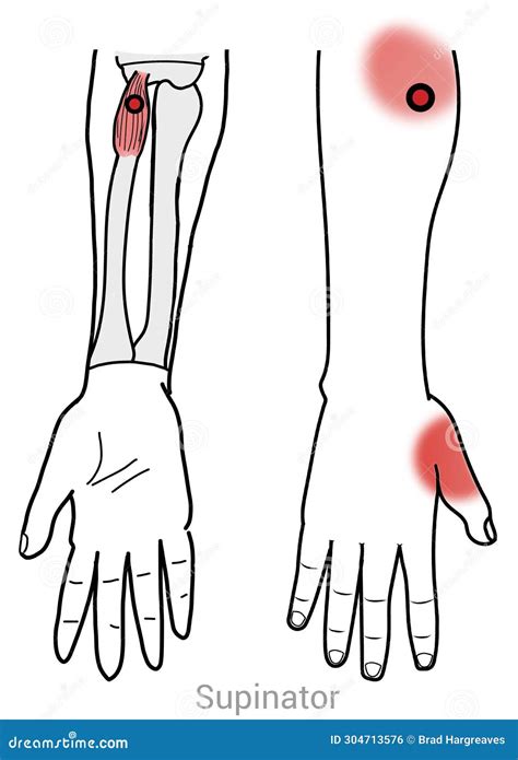 Supinator Stock Illustration Illustration Of Myofascial 304713576