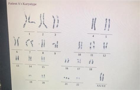Solved Interpreting The Karyotype Lab Technicians Compile