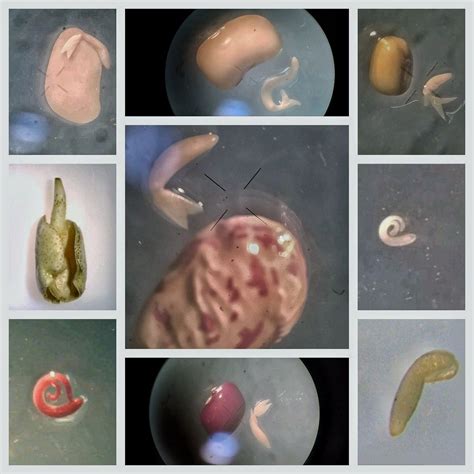 Embryonic Axis Extraction For Seed Amirreza Akbarfakhrabadi Posted On