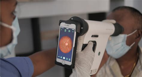 Icymi Smartphone Based Fundus Camera Provides Option For Glaucoma Screening