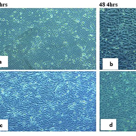 Control Untreated Human Hela And Hct Cell Lines Panels Ac Show