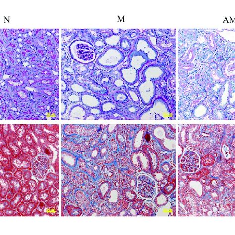 Heatmap Of Hierarchical Clustering Analysis Of The Differential Download Scientific Diagram