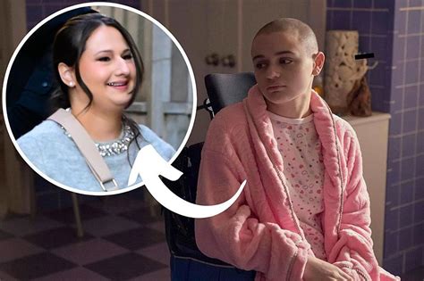 Joey King Gives Recovery Update After Facial Burn Accident