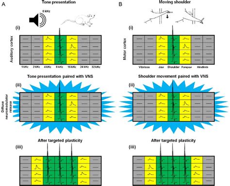 Figure 1 From Targeting Plasticity With Vagus Nerve Stimulation To Treat Neurological Disease