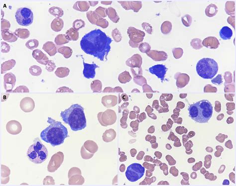 Advances In Clinical And Experimental Medicine