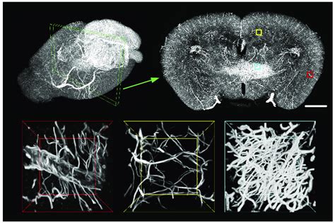 Whole Mouse Brain Vasculature Image Acquired By Fluorescence Download Scientific Diagram