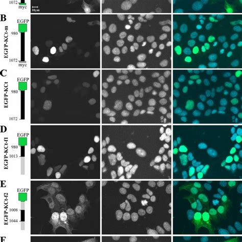 Subcellular Localization Of Kiaa0319 Cytoplasmic Domain Proteins