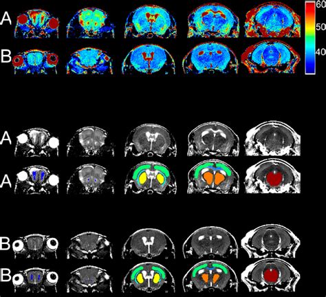 In Vivo Tracking Of Edema Development And Microvascular Pathology In A Model Of Experimental