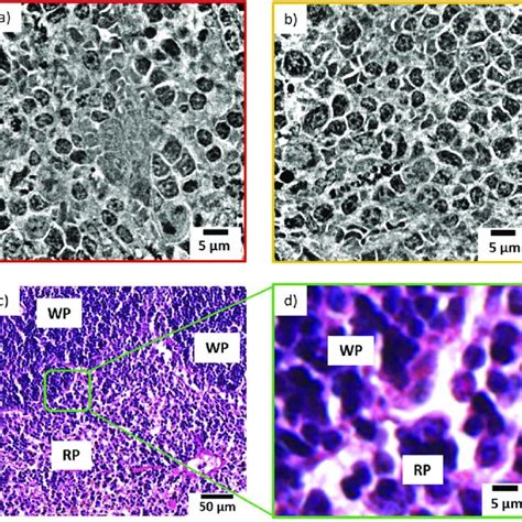 A 3d Volume Rendering In Grey Scale Of A Volume Of Interest Derived Download Scientific