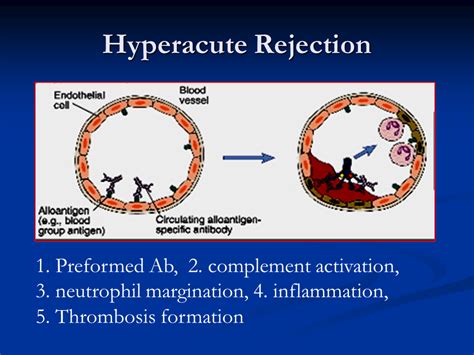 Transplantation Immunology Presentation Biology