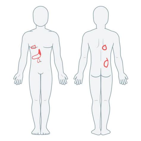 Got Diagnosed With Gastritis But My Symptoms Are All Over The Place Story In Comments R