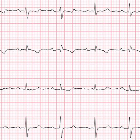 What Is Sine Wave And Why Is It Important