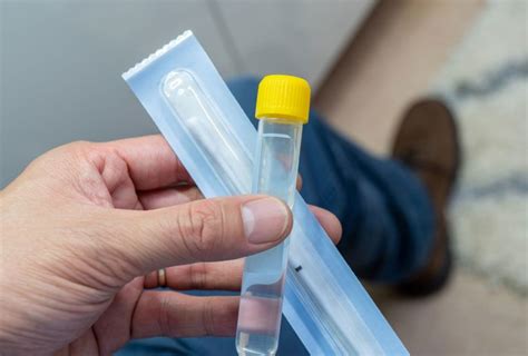 Sti Testing Douglass Hanly Moir Pathology