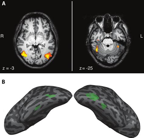 Location Of Occipitotemporal Body Selective Regions Extrastriate Body