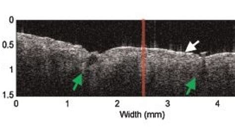 Computational Approach Speeds Up Microscopy Imaging Tech Briefs