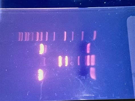 Activity 5 Restriction Fragment Analysis Using