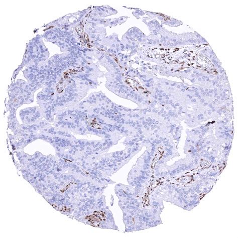 Cancer Tissue Gallery Mtap Ms Validated Antibodies