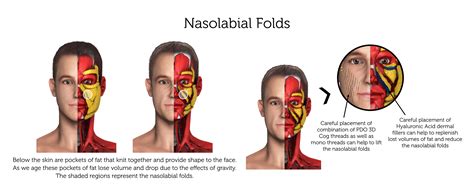 What Is A Nasolabial Groove At Joyce Dean Blog