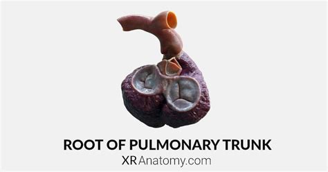 Root Of Pulmonary Trunk In Ar For Free