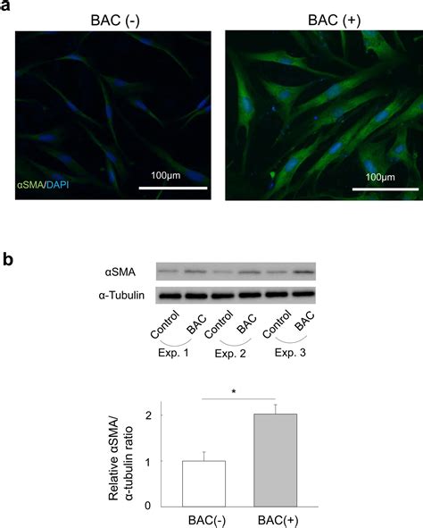苯扎氯铵诱导的 Tenon 囊成纤维细胞的肌成纤维细胞转分化受到角膜上皮细胞共培养或白细胞介素10 的抑制 细胞动态共培养系统 Naturethink