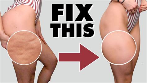 Cellulite Before And After Weight Training