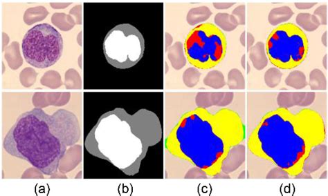figure 1 from deep features aggregation based joint segmentation of