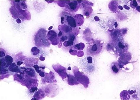 Diff Quik染色液(三试剂) 病理染色液 产品专区 南京建成生物工程研究所 Diff Quik染色液(三试剂) 病理染色液 产品专区 南京建成生物工程研究所