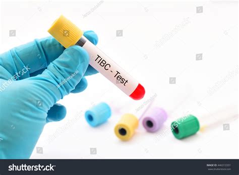 Blood Sample For Total Iron Binding Capacity Tibc Test Diagnosis For Anemia Disease Stock