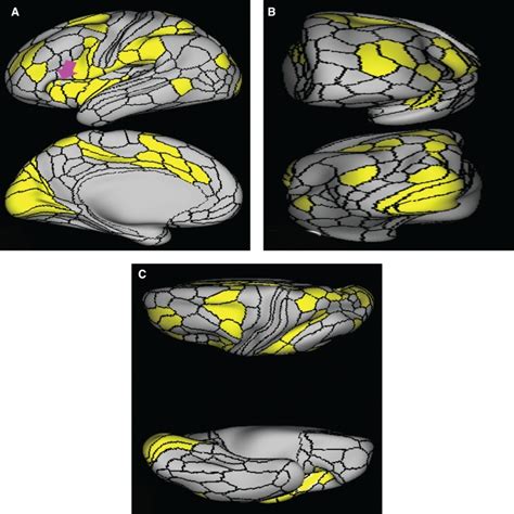A Connectomic Atlas Of The Human Cerebrum Chapter 5 The Insula And