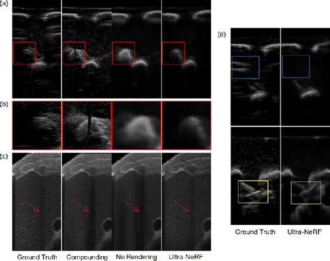 figure 1 from ultra nerf neural radiance fields for ultrasound imaging