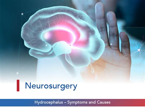 Hydrocephalus Symptoms And Causes Sparsh Hospital