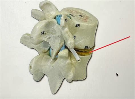 [solved] Can You Help Me Identify The Highlighted Structure 58 55 564 Course Hero