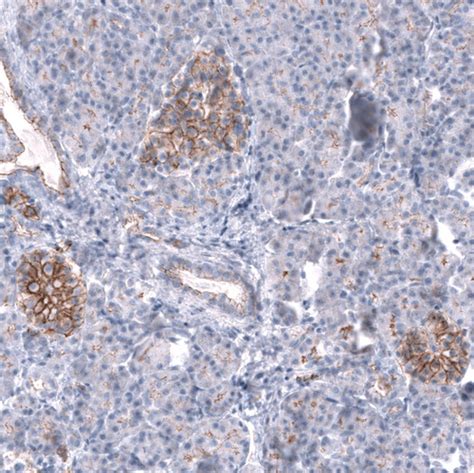 Anti Nectin3 Monoclonal Atlas Antibody