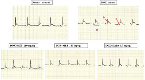 Qualitative Analysis Of Ecg A Prolongation Of The Qt Interval B Download Scientific Diagram