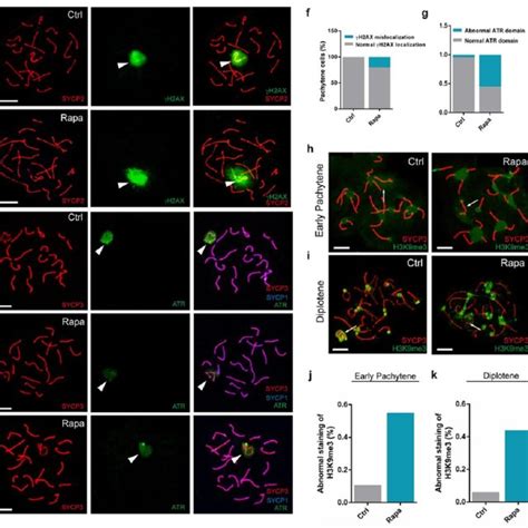 abnormal localization of sex body silencing factors in pachytene