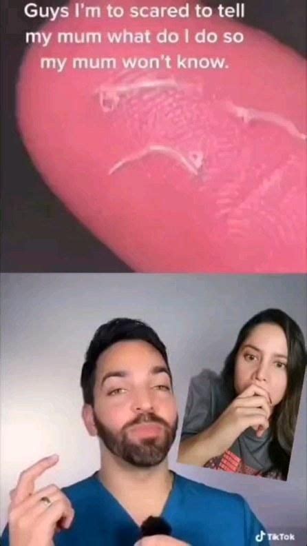 Pinworms Understanding The Common Parasitic Infection