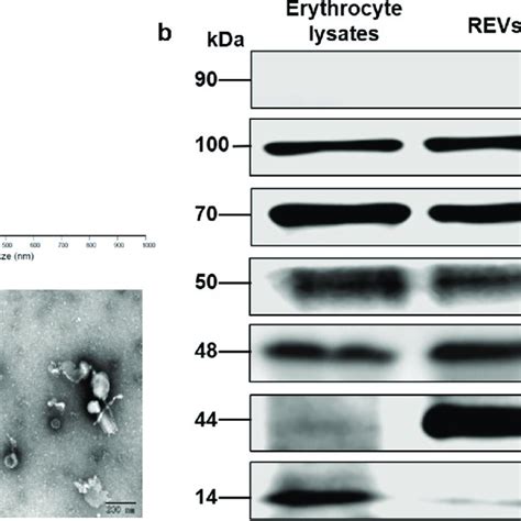 PDF Blood Cell Derived Extracellular Vesicles Diagnostic Biomarkers And Smart Delivery Systems