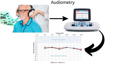 Audiometry Dr K P V Raos Health Blogs Audiometry Dr K P V Raos Health Blogs