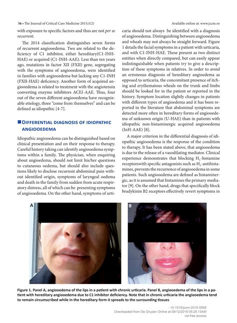 Solution Differential Diagnosis And Management Issues Of Idiopathic