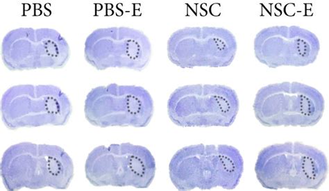 The Excitation Of Striatal Neurons After Nsc Transplantation Reversed