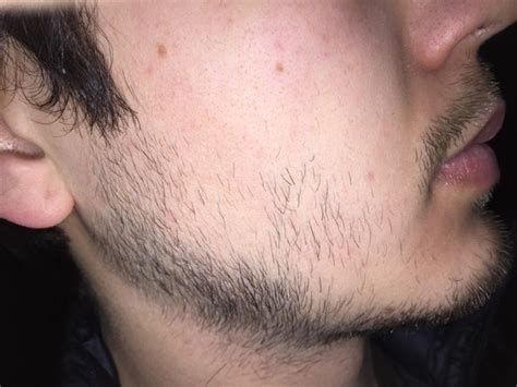 Yo First Time Patchy Beard Beard Board