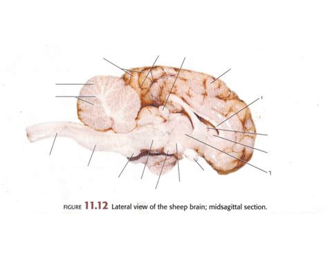 Lateral Ventricle Sheep Brain Lab 4