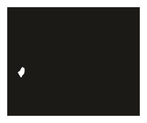 Laser Spot Segmenting Via Improved Morphological Band Pass Filter A