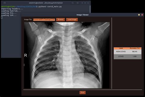 GitHub XXDIL COVID Classifier Using CNN And SVM